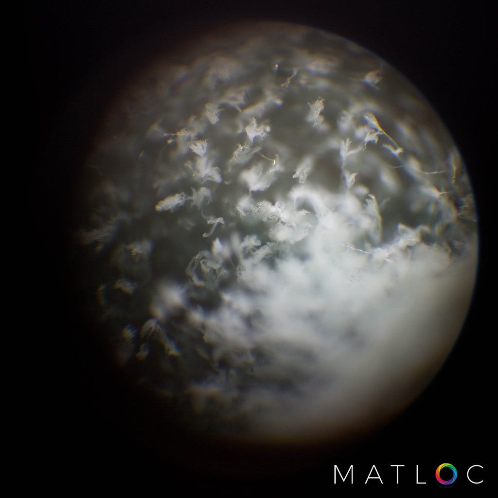 Bread Mold – Matloc Photography